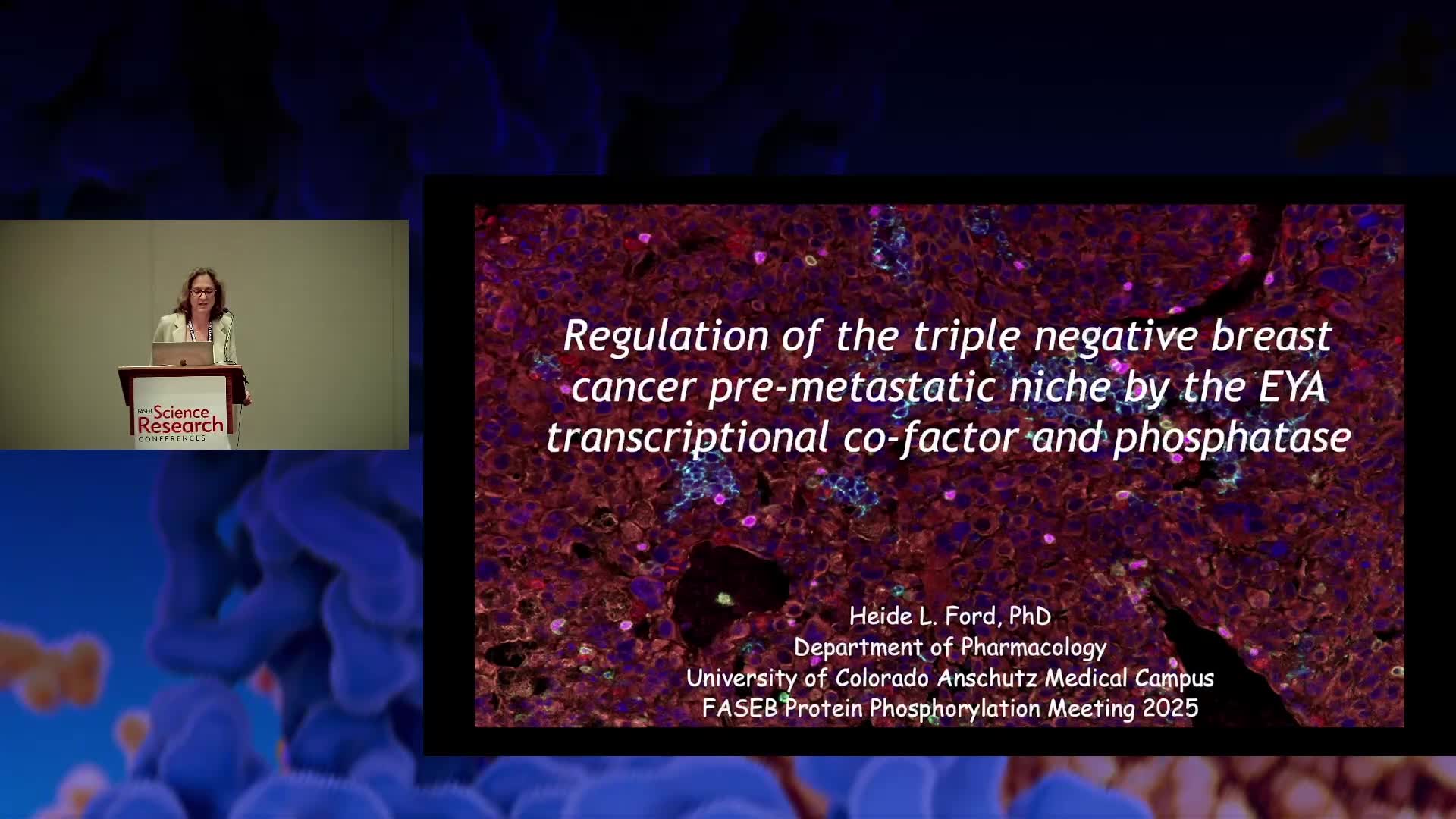 Regulation of the triple negative breast cancer pre-metastatic niche by ...