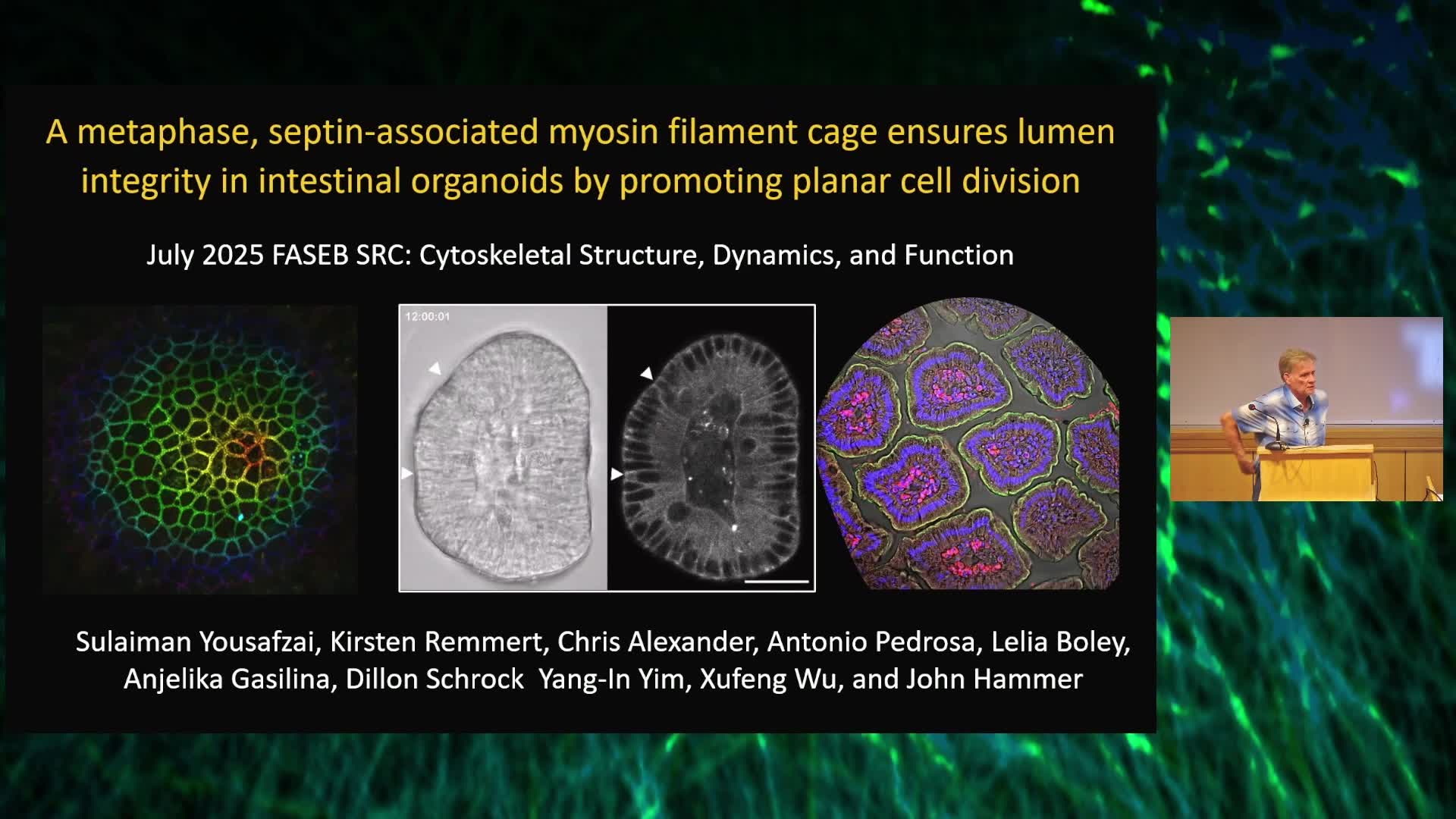 A metaphase, septin-associated myosin filament cage ensures lumen ...