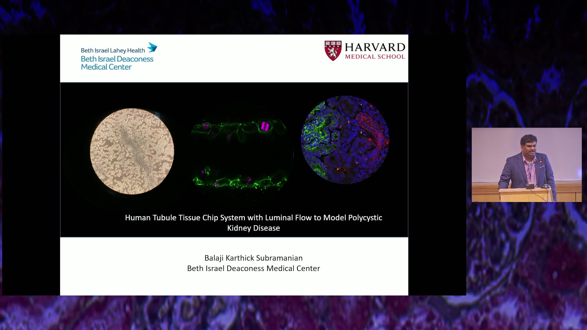 Human tubule tissue chip system with luminal flow to model polycystic ...