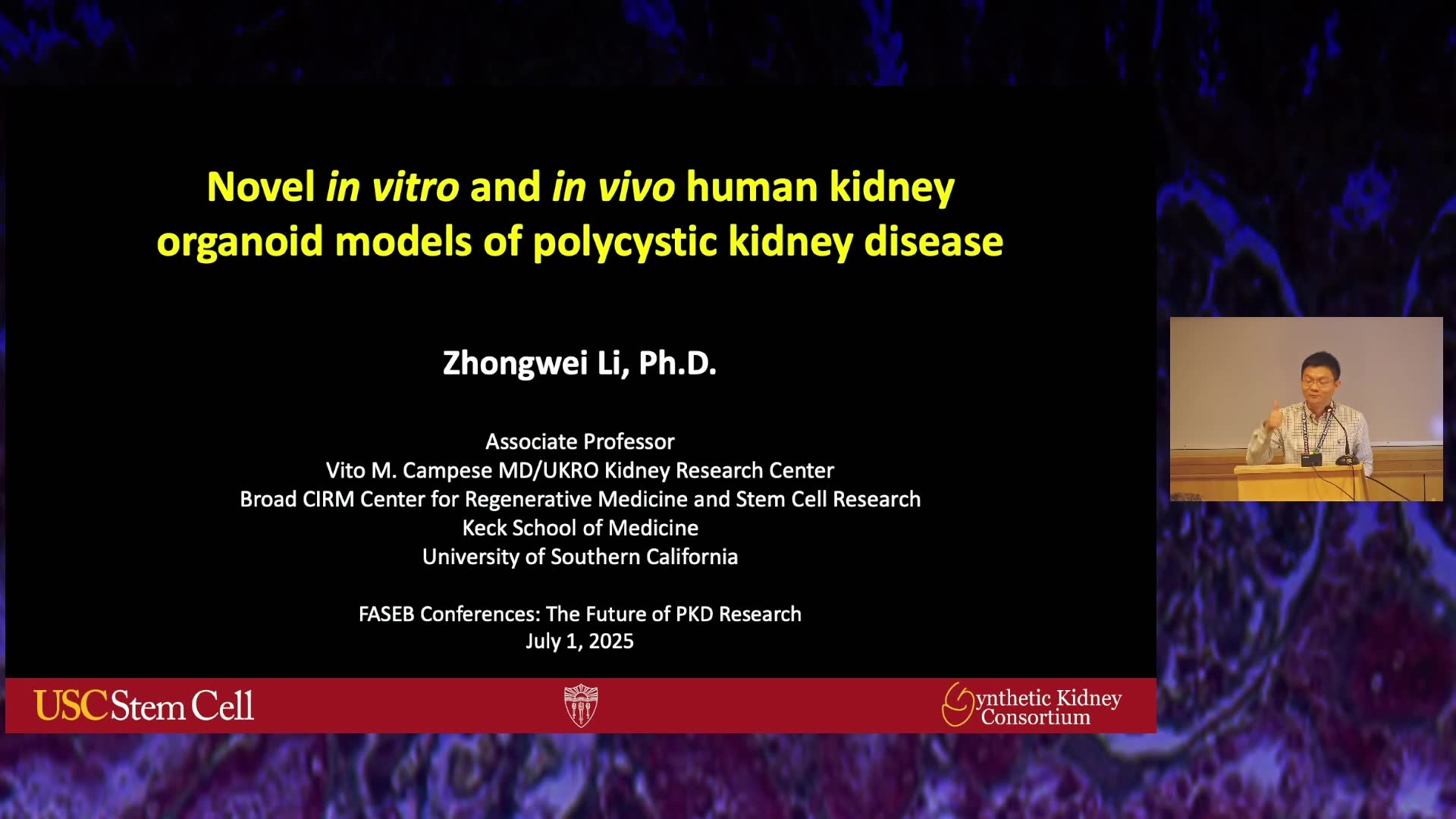 Novel in vitro and in vivo human kidney organoid models of polycystic ...